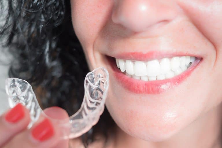 Understanding Invisalign Attachments - Hass Family Orthodontics